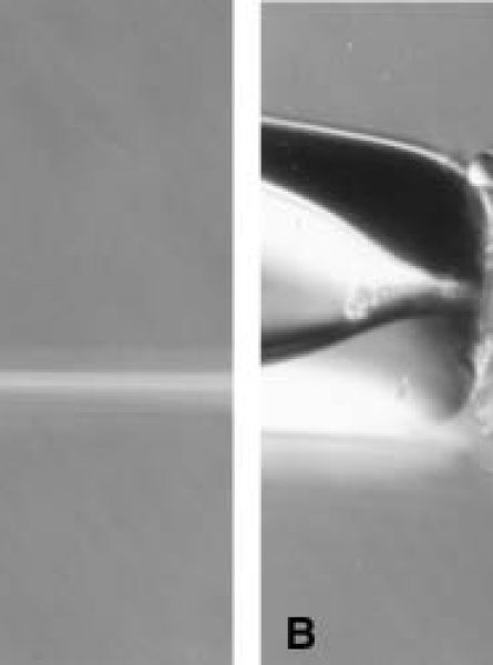 Laser Assisted Hatching | Red Rock Fertility Center